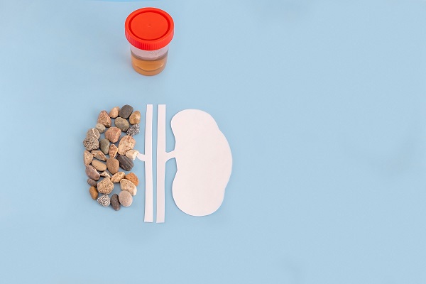 Why Regular Primary Care Blood Panel Testing For The Kidney And Liver 